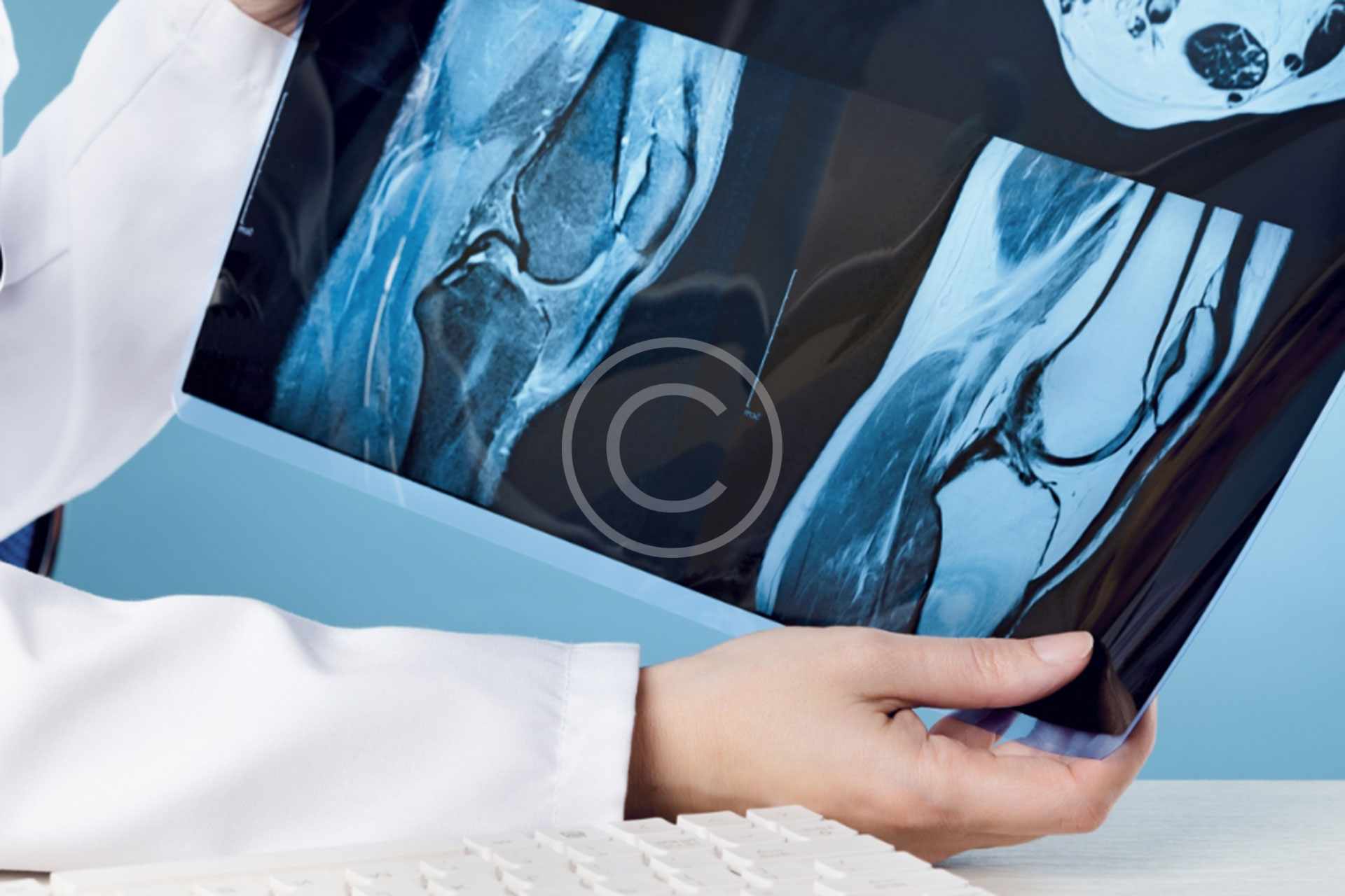 Common sports and exercise related injuries – Remake MedSpa